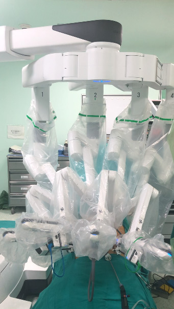 Robotic Surgery - Dr Pankaj Gaur Urologist